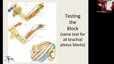 13-brachial-plexus-blocks-debroeck-mp4 – Summit Anesthesia Seminars